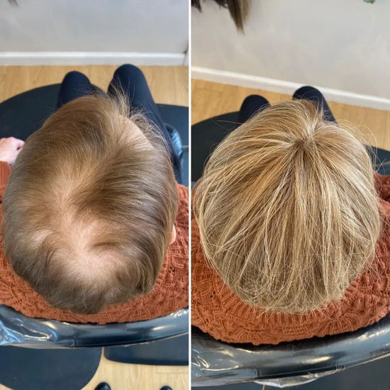 Nice Short Wiglets Hair Pieces for Women with Thinning and Fine Hair ...